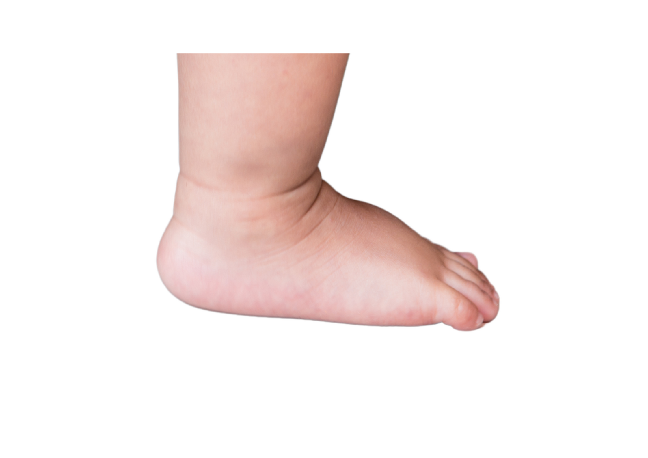 Tipos de empeine – Uma Ergonomics